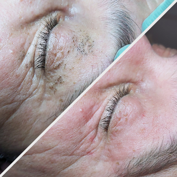 Skin Improvement | Jereth Meert